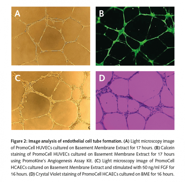 TODO SOBRE HUVEC: preguntas y respuestas | Labclinics | Kathryn Coltrin
