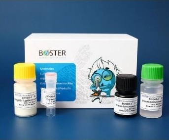 Boster Bio – Antibody and ELISA experts | labclinics.com