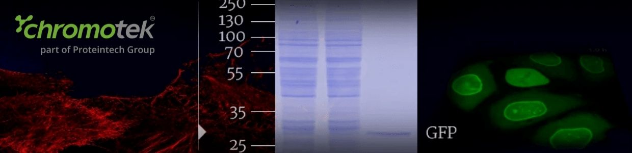 GFP Trap para Inmunoprecipitación